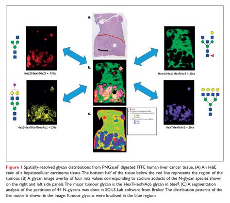 Innovative Glycan Imaging Methods Drive Cancer Biomarker Discovery Drug Discovery World Ddw