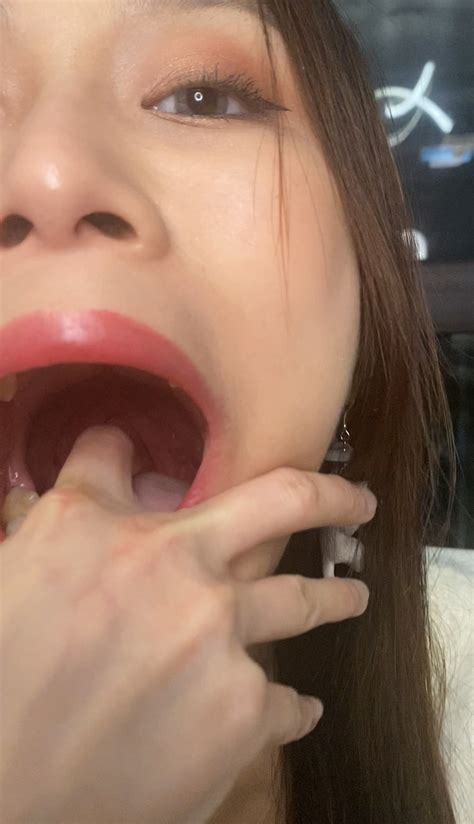 Asian Girl Uvula Video ThisVid Com Asian Girl Uvula Video ThisVid Com