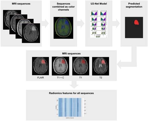 Deep Learning For Automated Glioma Segmentation Mri Processing With Download Scientific