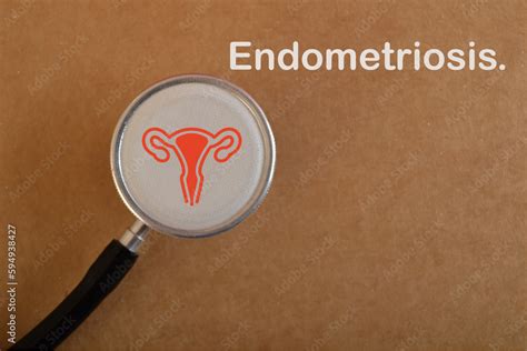 Vagina Symbol On Stethoscope With Text Endometriosisendometriosis Is A
