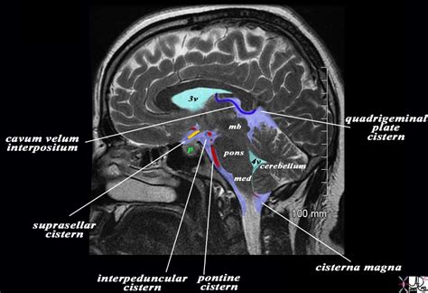 Ambient Cistern The Common Vein
