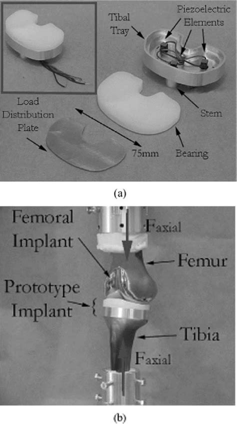A Self Powered Tkr Model And Test Setup Components Of The Implant