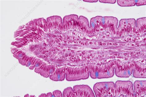 Small Intestine Light Micrograph Stock Image C054 3074 Science Photo Library