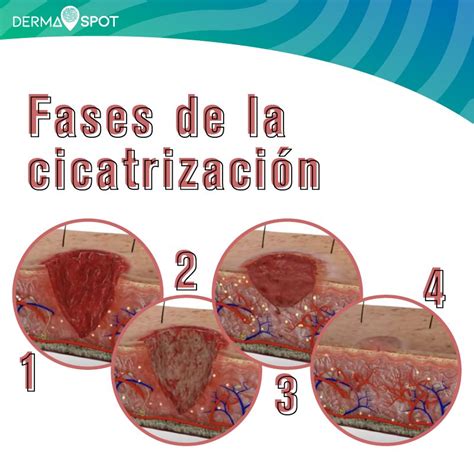 Cicatrización