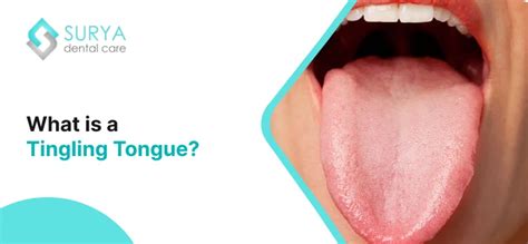 What Is A Tingling Tongue