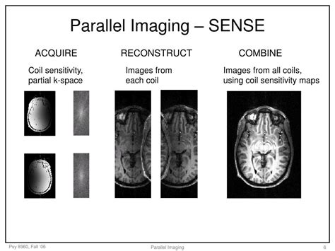Ppt Parallel Imaging Powerpoint Presentation Free Download Id1298946