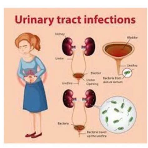 Urinary Tract Infection Treatment In Noida By Homoeopathic World Id