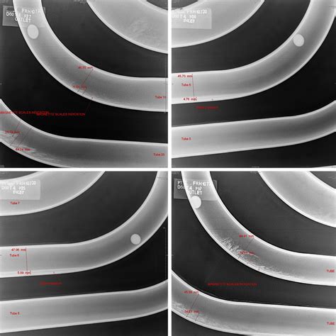 Radiography Testing Robutech