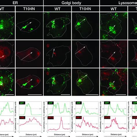 Chmp2b With The T104n Mutation Forms Aggregate Like Structures In The