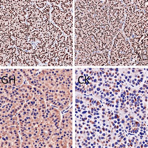 Immunohistochemical Features Of A Multilineage Pitnet Expressing Pit1 Download Scientific