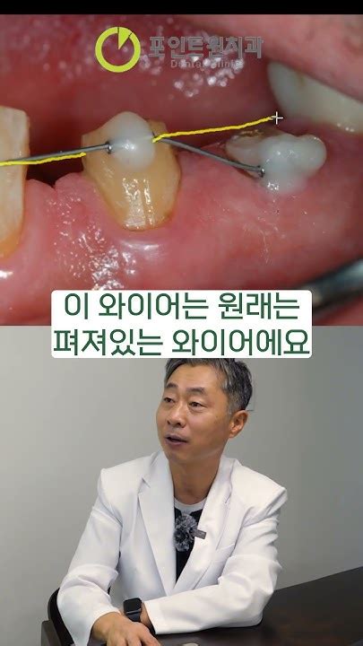 잇몸 아래에 있던 뿌리를 올려서 쓸 수 있는 이유 Feat 인체의 신비 Youtube