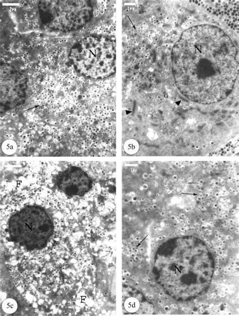 Beta Cells Electron Micrograph Of Rat Pancreas Showing A And B