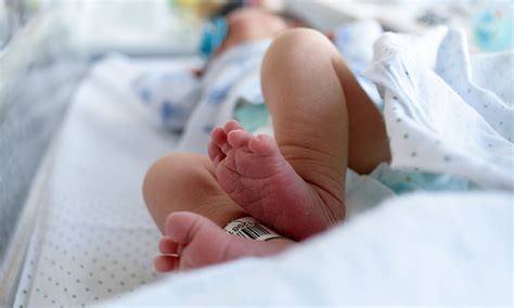 Clinical Assessment For Neonatal Hypotonia Norton Healthcare Provider