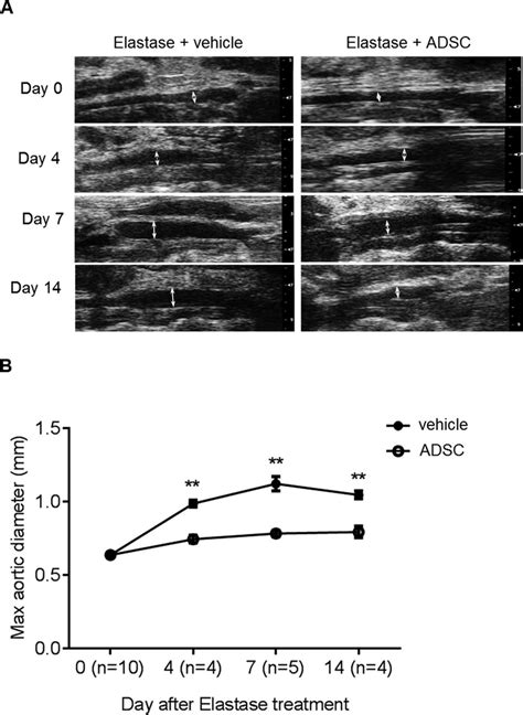 Human Adscs Suppress Elastase Induced Aaa Expansion In C57bl 6 Mice