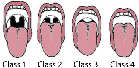 When To Call The Anesthesiologist For Assistance With Sedation