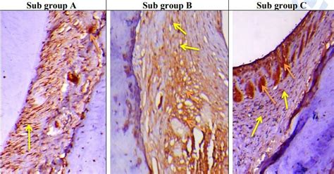 Sub Gp A A Photomicrograph Of The Pdl Fibers Of Group Ii At 7 Th Day Download Scientific