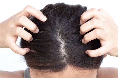 What Causes Dry Scalp Major Reasons Explained