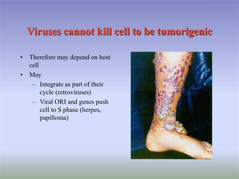 Ppt Oncogenic Viruses Powerpoint Presentation Free Download Id