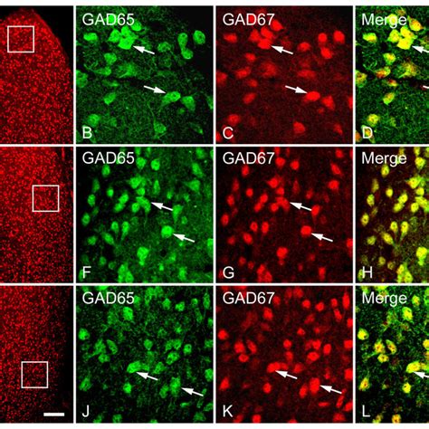 In Situ Hybridization Dig At Hannah Macdonell Blog