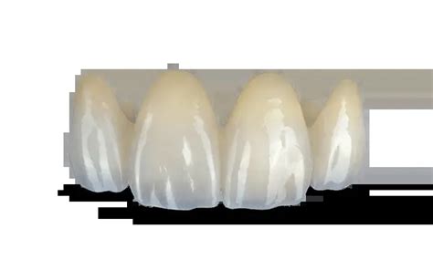 Crown And Bridge Vta Dental Lab