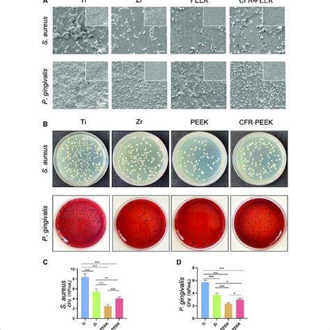 The Osteogenic Gene Expression Of Four Different Implant Materials A