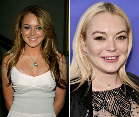 Celebrity Face Lifts 60 Photos Moonagedaydreamfilm