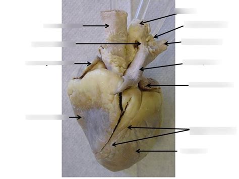 Lab Practical 1 Diagram Quizlet
