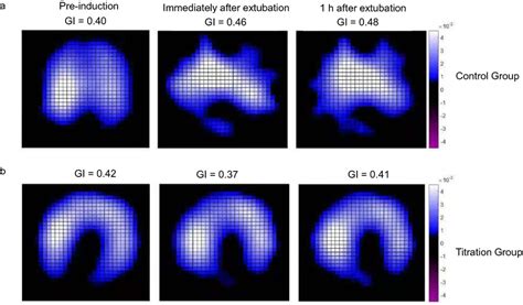 Representative Images Showing Tidal Variation Measured By Electrical Download Scientific