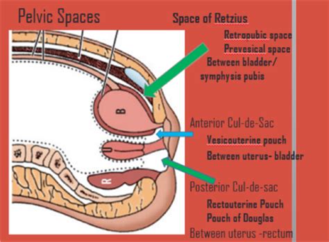 Space Of Retzius