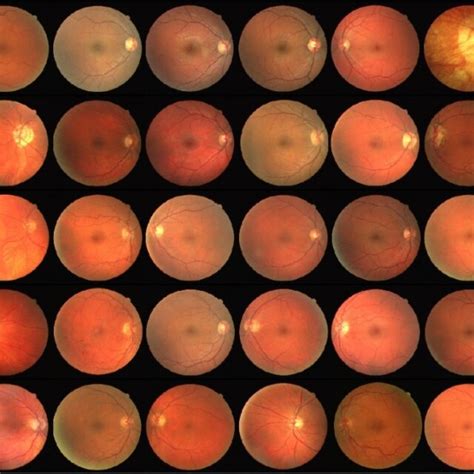 Drive Dataset Images [25] Download Scientific Diagram