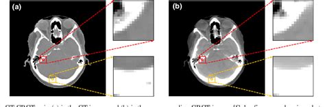 Figure 3 From Learning‐based Cbct Correction Using Alternating Random Forest Based On Auto