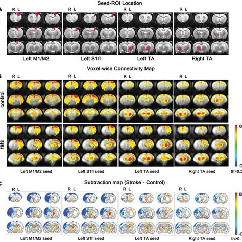 Functional Connectivity Maps According To Seed Rois M1 M2 S1fl And Download Scientific