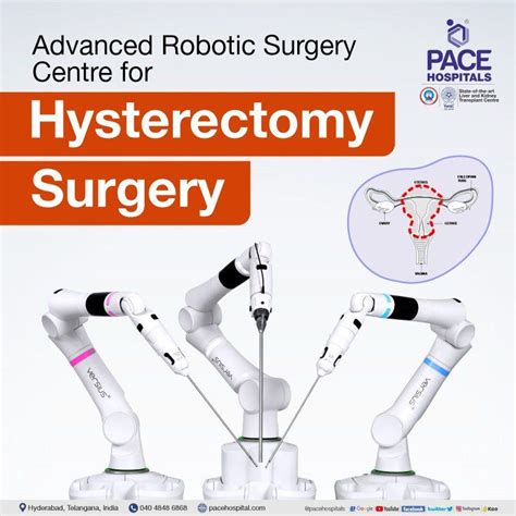 Hysterectomy Surgery In Hyderabad Procedure And Cost