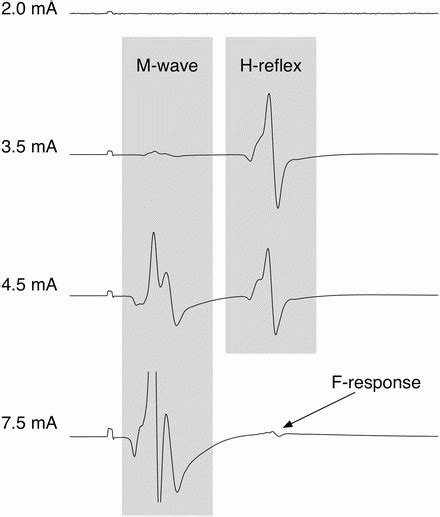 the h reflex and f response neupsy key