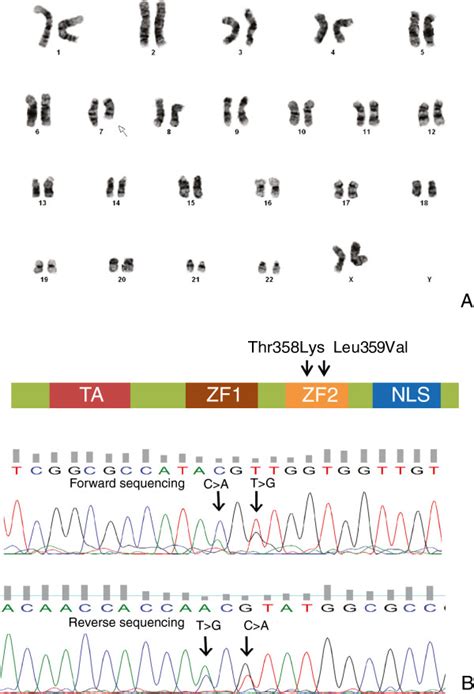 Cytogenetic And Molecular Findings Of Familial AML MDS With Inherited Download Scientific