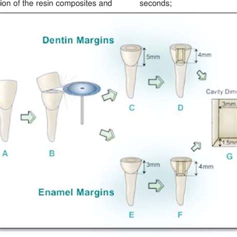 Class Ii Mod Cavities Showing The Additional Retention Design Of The