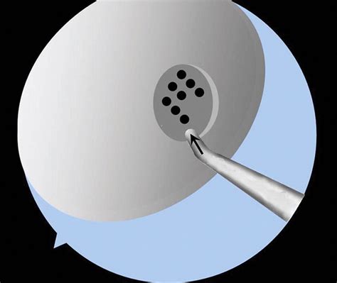 Ace Physical Therapy And Sports Medicine Institute In Falls Church Herndon Alexandria Fairfax