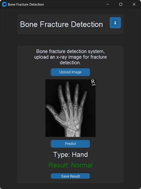 Beginner Hackathon Ai Fracture Detection Devpost