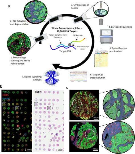 Digital Spatial Profiling Of The Microenvironment Of Muscle Invasive Bladder Cancer