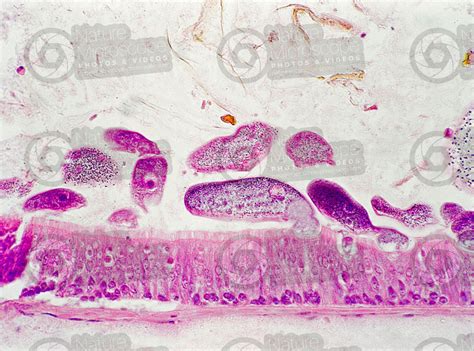 Gregarina Sp Transverse Section 250x Protozoa Protozoa Endoparasites Parasitology Photos