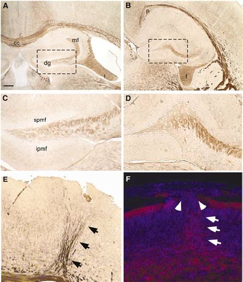 Abnormal Axonal Trajectories In Fe65 À À Fe65l1 À À Mouse Cortex