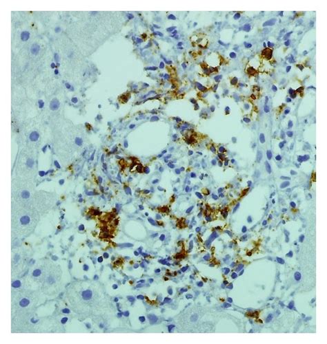 Representative Microphotographs Of Cd20 Marker By Immunohistochemistry Download Scientific