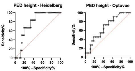 Undetectable Macular Neovascularization On Oct Angiography In Age Related Macular Degeneration