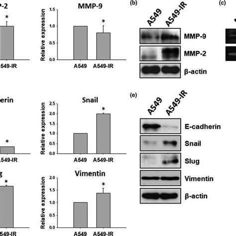 Emt Characteristics Of A549‐ir Cells A B Expression Levels Of Mmp‐2