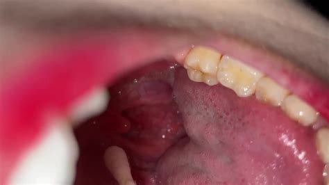 Cute Uvula Video Thisvid Com