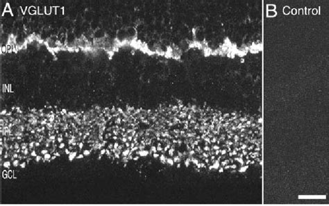 C Terminal Binding Protein 2 Semantic Scholar