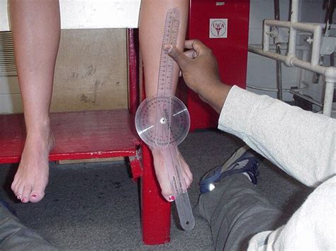 Goniometer Of Eversion Free Education Physiotherapy Occupational Therapy