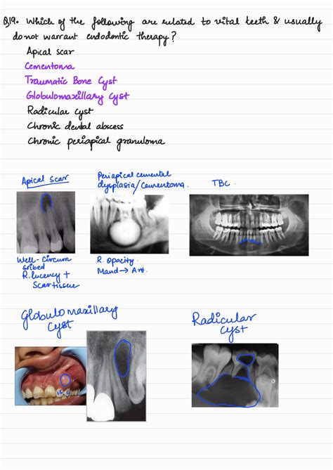 Practice Questions For Endodontics Nbde Neet Mds Extooth