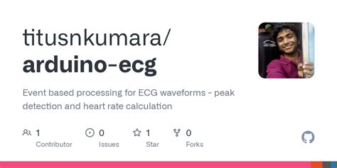 Github Titusnkumara Arduino Ecg Event Based Processing For Ecg Waveforms Peak Detection And