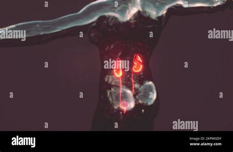 Urinary Bladder Disease Stock Videos And Footage Hd And 4k Video Clips Alamy